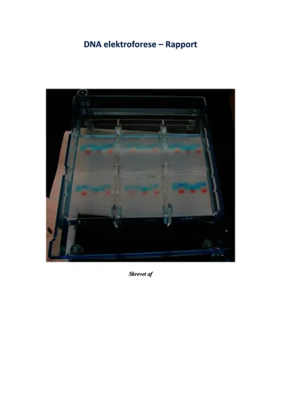 DNA elektroforese - Hvem stjal kagen? - Biologi - Opgaver.com